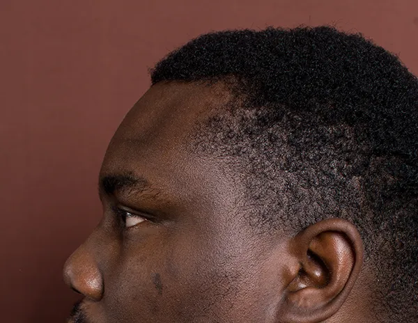 Black men skin care: a chemist's guide to dark spots and routines